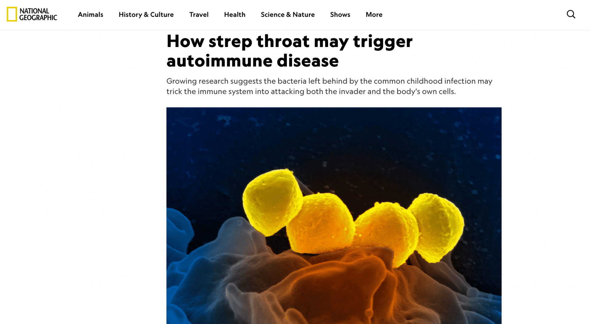 How strep throat may trigger autoimmune disease - National Geographic ...